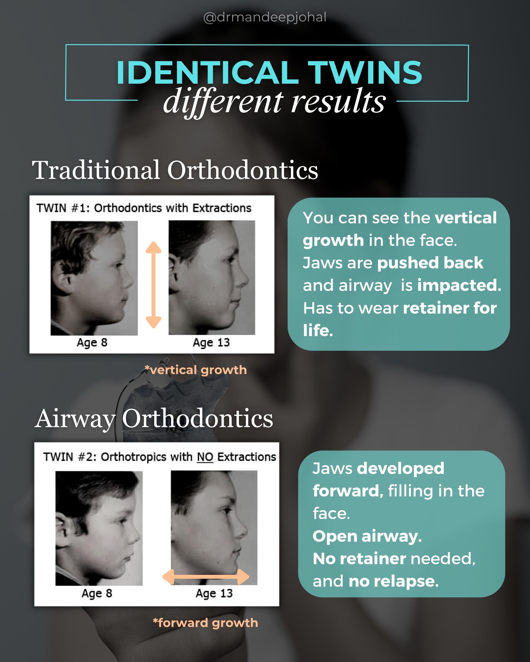 Exploring the Breath of Change: Traditional Orthodontics vs. Airway ...